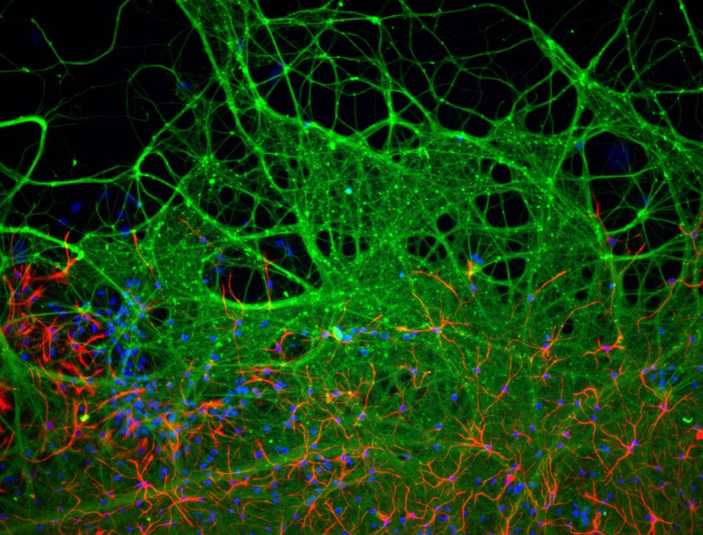 “The Well-Tempered Brain” or: What thinking sounds like - Global Young ...